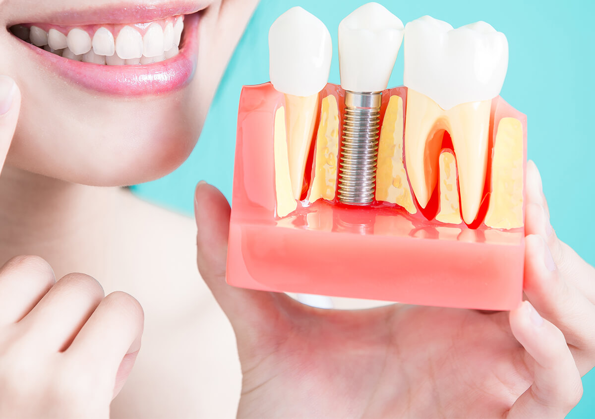 dental-implants-archives-we-smile-dentistry
